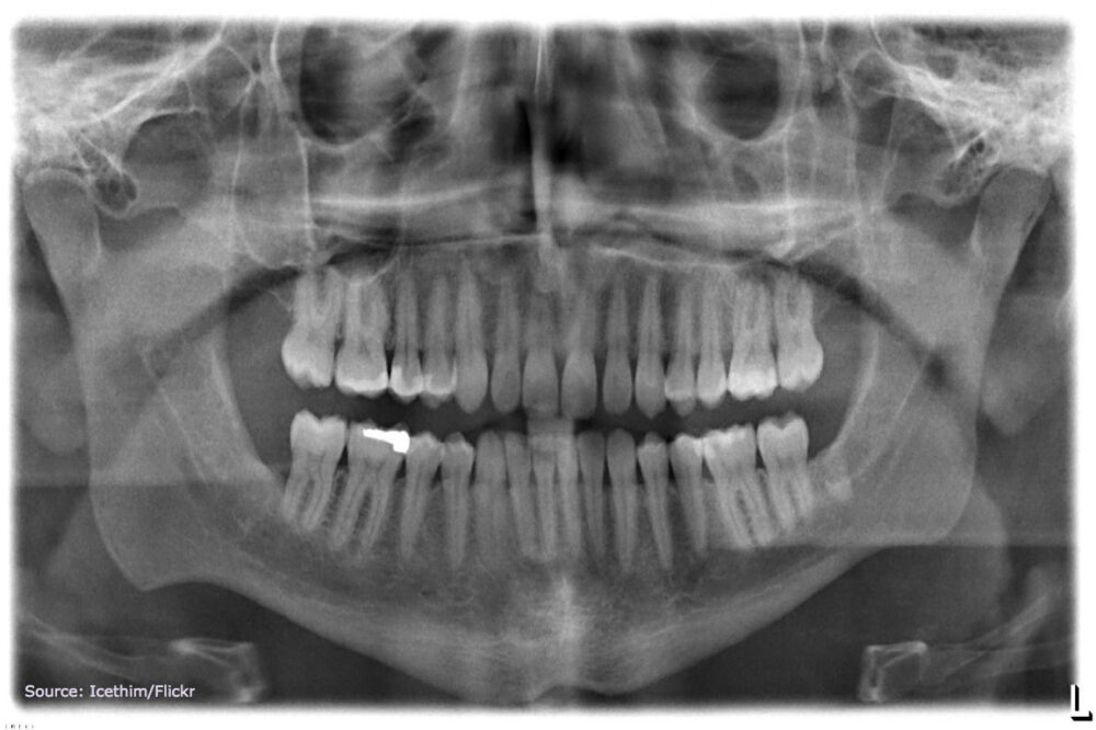 NYPD Says ‘Trust Us’ on Potentially Dangerous X-Ray Vans Roaming the ...